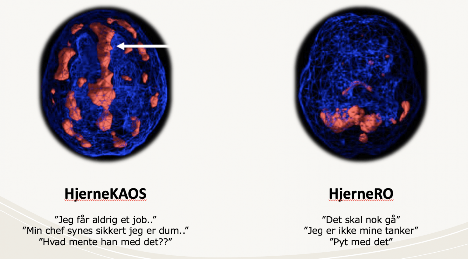 Tankemylder: Sådan fjerner du det (uden at gå til psykolog)